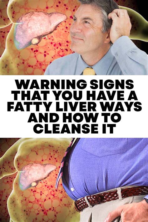 Warning Signs That You Have A Fatty Liver Ways And How To Cleanse It In