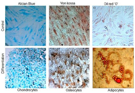 Differentiation Potential Of Hadscs Cultured On A Chitosan Based