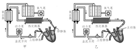 新冠疫情期间ECMO体外肺膜氧合技术的使用挽救了许多危重患者的生命ECMO技术的原理是将体内的静脉血引出体外经过人工心肺旁路氧合后注入病人
