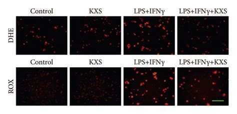 Effect Of Kxs In Lpsifnγ Induced Oxidative Stress And Mitochondrial