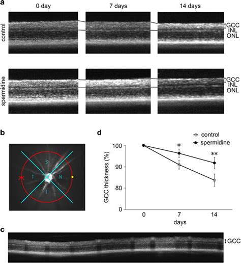 In Vivo Imaging Of The Retina In Control And Spermidine Treated Mice