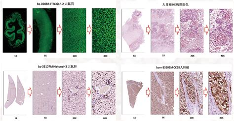 全视野数字切片扫描分析