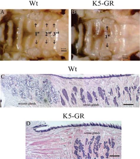 Figure 2 From Ectoderm Targeted Overexpression Of The Glucocorticoid Receptor Induces