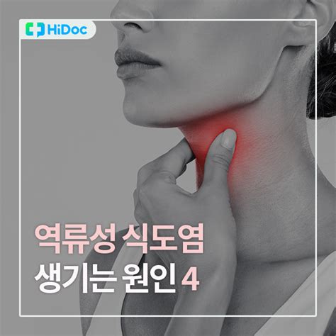 역류성 식도염 생기는 원인 4 카드뉴스