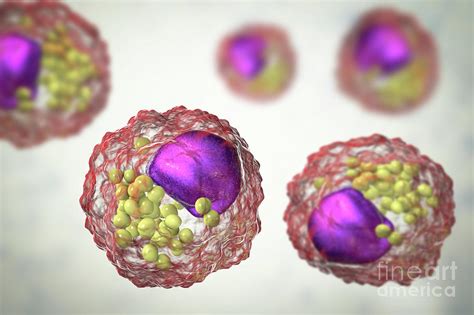 Macrophage Foam Cell Photograph By Kateryna Kon Science Photo Library