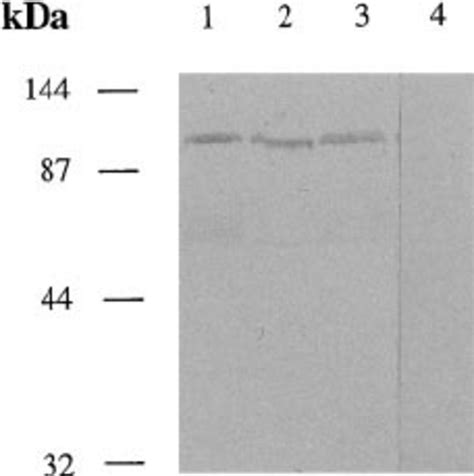 Immunoblot Analysis Of Microsomal Membrane Proteins From Control Lane Download Scientific