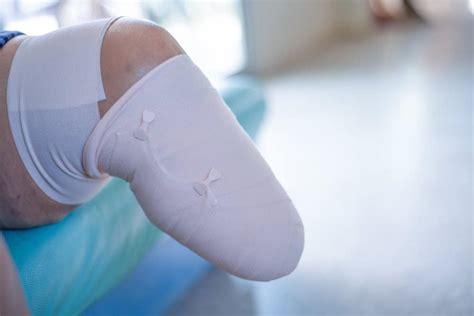 Jenis Luka Amputasi Diabetes Ini Sebab Kenapa Kena Potong Kaki