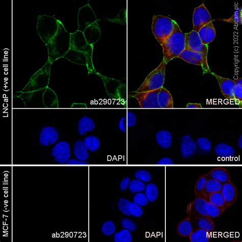 Anti Steap1 Antibody Epr26044 70 20 Ul Size Ab290723 Abcam