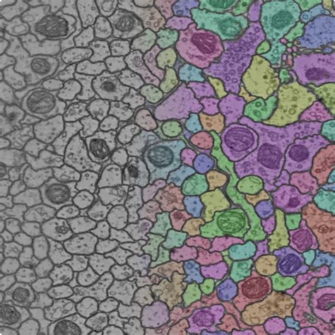 Segmenting Brain Images A Deep Learning Approach By Georg Wiese