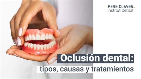 Oclusión dental tipos causas y tratamientos Institut Dental Pere Claver