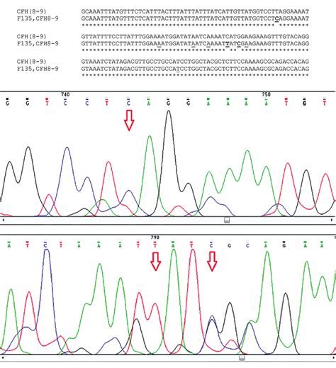 Analysis Of Cfh Exon 9 Sequencing Top Aligned Sequence Of The Patient