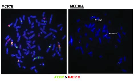Detection RAD51C ATXN7 Fusion By FISH Metaphases Of MCF 7 And MCF10A Download Scientific