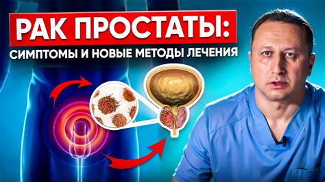Рак предстательной железы Симптомы рака простаты методы лечения и профилактика рака простаты