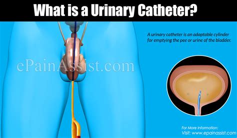 Urinary Catheter Uses Types Effects On Sex Life And Preventing