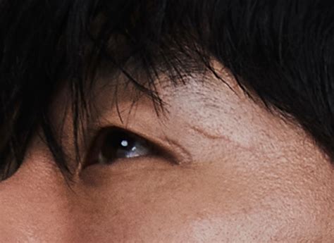이슈유머 손흥민 안와골절 수술 흉터 보이는 화보 사진