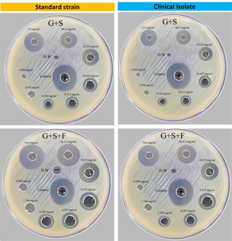 Inhibition Zones Created By Gs And Gsf In Competition With The