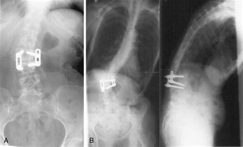 Gr4 Musculoskeletal Key