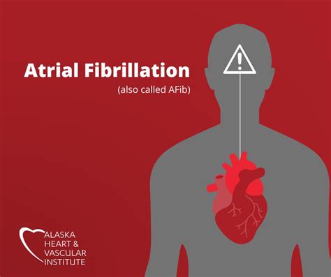 Alaska Heart And Vascular Institute Atrial Fibrillation Afib Is A Common Heart Rhythm Disorder