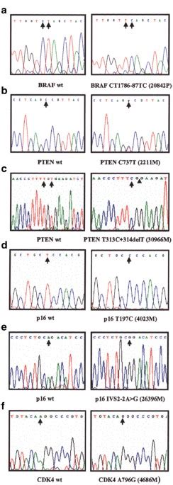 Braf Alterations Are Associated With Complex Mutational Profiles In