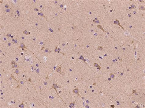 Anti Tyk2 Jtk1 Antibody Rabbit Pab 204222 T08 Sino Biological