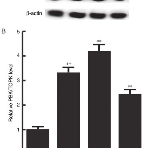 Pbk Topk Protein And Mrna Expression Levels In Lung Adenocarcinoma Cell
