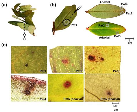 Fig S10 Hypericum Patulum Plant And Different Leaf Glands Under Our