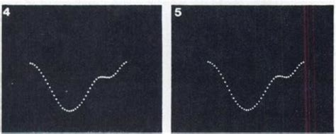 Typical Lv Time Activity Curve And Approximations To It Using 1
