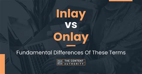 Inlay Vs Onlay Fundamental Differences Of These Terms