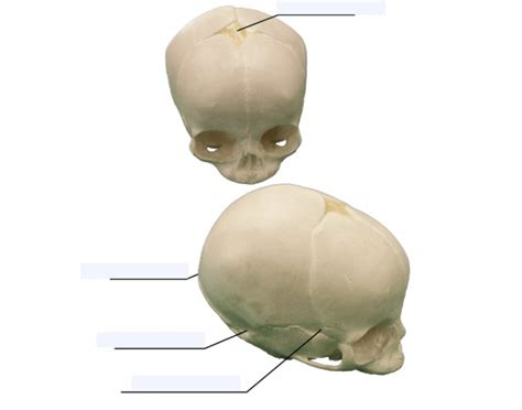 Fetal Skull Fontanel Quiz