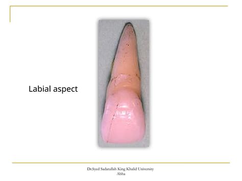 dokumen tips maxillary incisors ppt