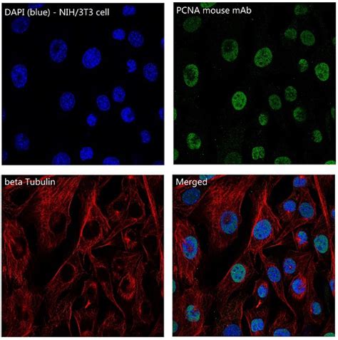 Beta Tubulin Rabbit Mab Sab Signalway Antibody
