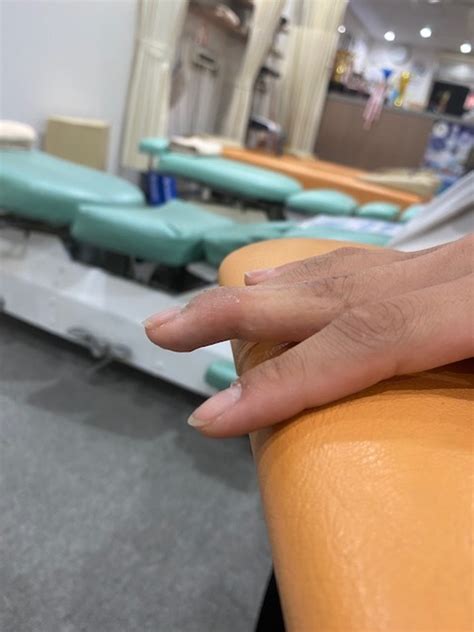 突き指をしてしまった！？ ー宇治市 六地蔵 みやもと整骨院 捻挫 マレットフィンガー 骨折ー｜宇治市六地蔵駅（伏見・山科）最寄りのみやもと整骨院