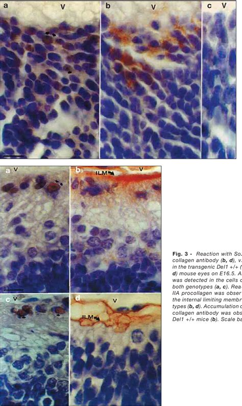 Figure 3 From Expression Of Sox9 And Type Iia Procollagen During Ocular