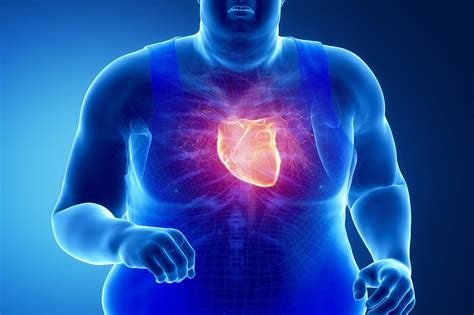 A Heavy Toll Two Thirds Of Deaths Related To High Bmi Are Due To