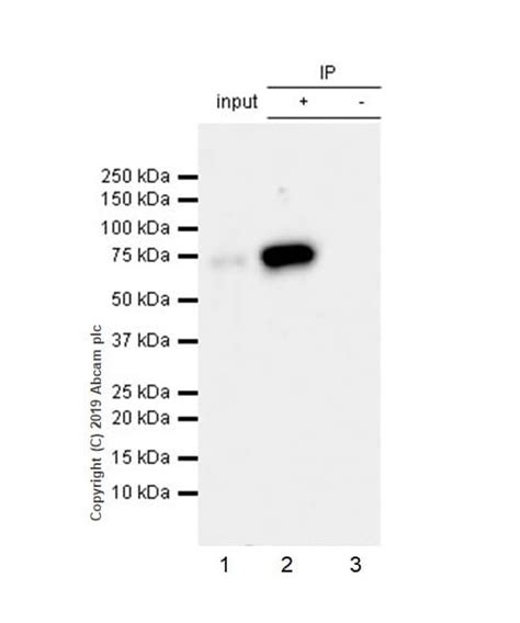 Extracellular matrix蛋白 重组抗体 EPR Extracellular matrix蛋白 抗体 ab