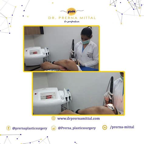 Prerna Mittal On Linkedin Photofacial Prernamittal Aestheticclinic