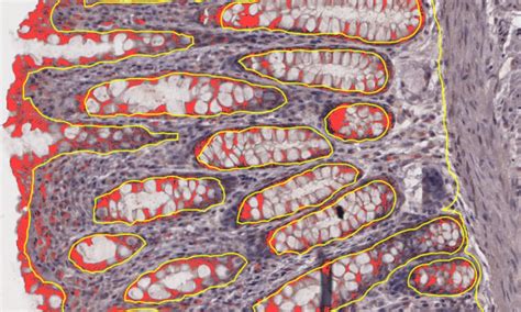 Help Using Cellprofiler For Ihc Tissue Analysis Image Analysis Imagesc Forum