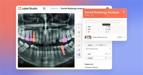 Medical Data Labeling And Label Studio Humansignal