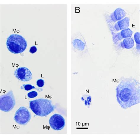 Overview Of Cells Found In A Bronchoalveolar Lavage Sample From Two