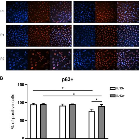Immunostaining for the putative limbal stem cell marker p63α in