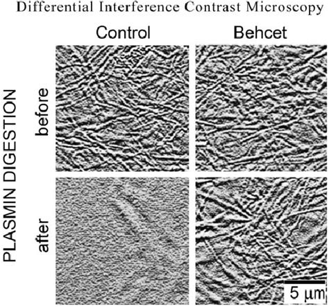 Representative Differential Interference Contrast Dic Microscopy