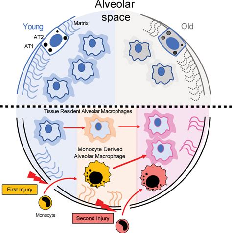 The Lung Microenvironment Shapes A Dysfunctional Response Of Alveolar