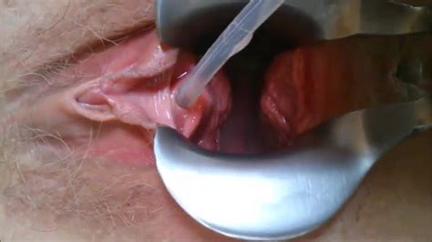 Catheter Play With Speculum 中文