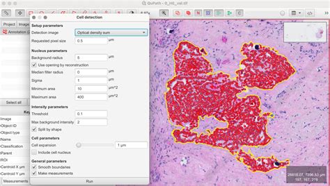 Qupath Cell Counting Cancer Informatics