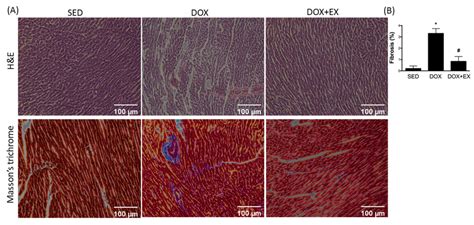 Massons Trichrome Staining Of The Cardiac Tissues Representative