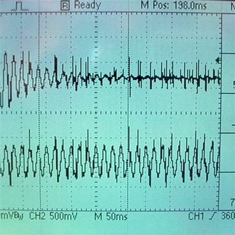 Dsp In Verilog When It Needs To Be Fast