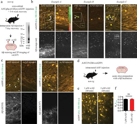 Intracranial Injection Of Oligomeric Aβ Oaβ Drives Ox Stress