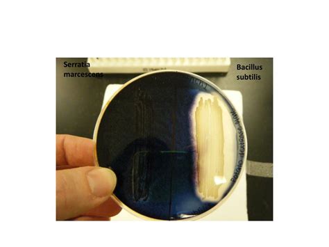 Ppt Tsi Agar And Biochemical Id Labs Powerpoint Presentation Free