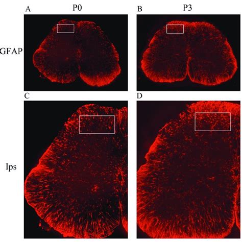 Neutrophil Infiltration In The Sciatic Nerve In A Wild Type Mouse Download Scientific Diagram