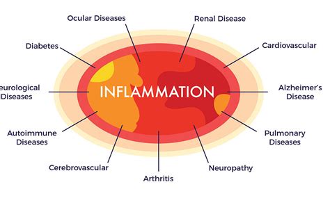 Chronic Inflammation Is That All There Is To Disease Ambrose Cell